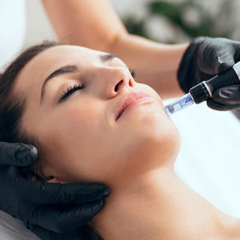 Lip Fillers - DSC - Aesthetics skin clinic