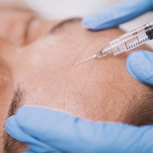 Wrinkle Relaxing Injections - DSC - Dermatology Skincare Centre Wrinkle Relaxing Injections - DSC - Dermatology Skincare Centre