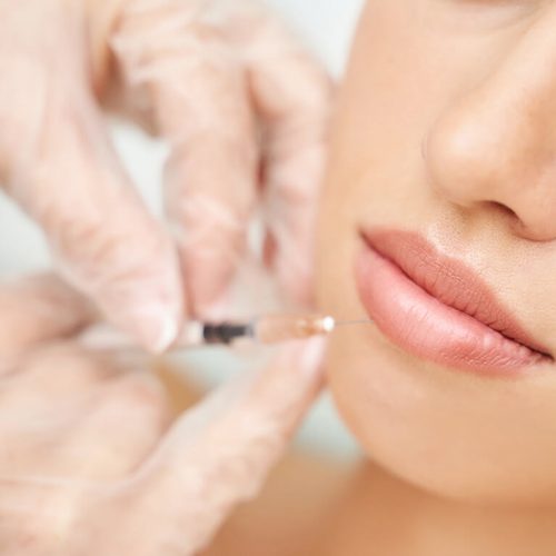 Wrinkle Relaxing Injections - DSC - Dermatology Skincare Centre Wrinkle Relaxing Injections - DSC - Dermatology Skincare Centre